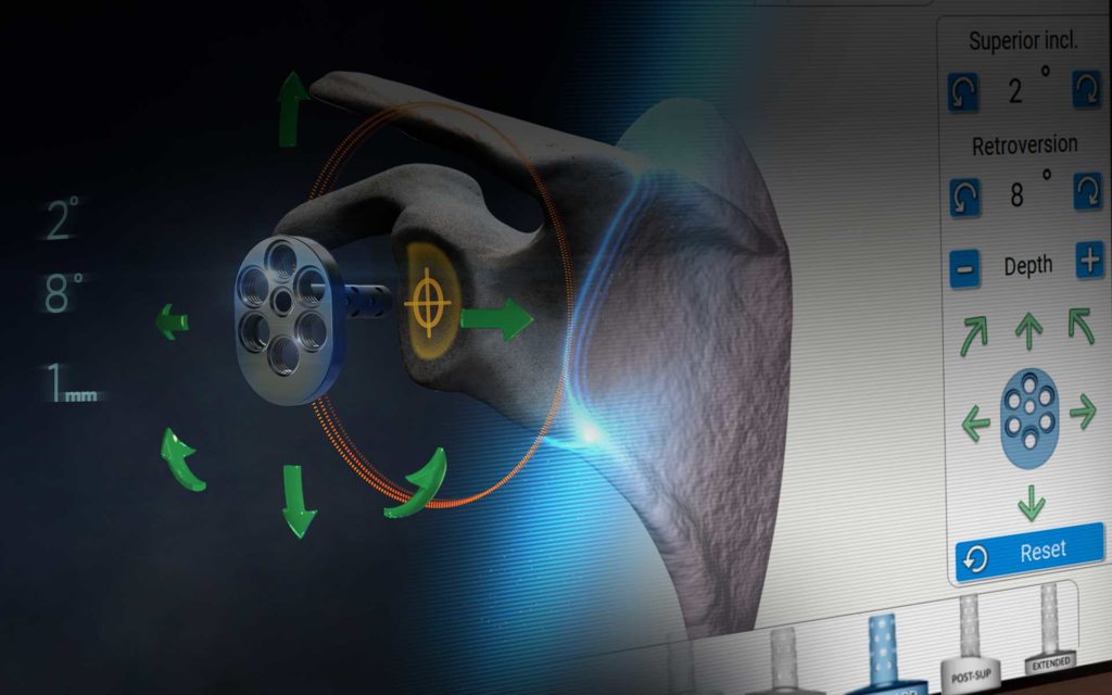 Equinoxe Planning App - www.exac.at